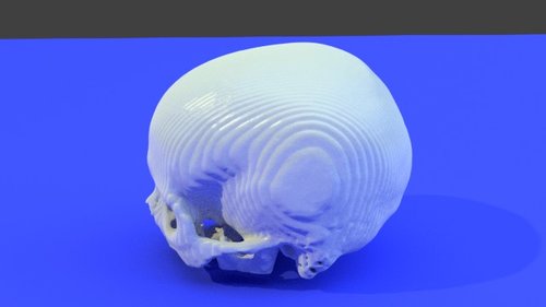 CT_Scan - stl file processed - Skull and Face - embodi3D.com