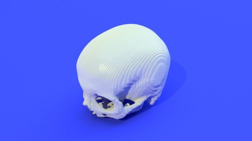 CT_Scan - stl file processed - Skull and Face - embodi3D.com