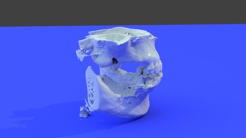 instructable 3d model of the maxillofacial - stl file processed ...