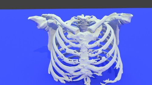 Ct - stl file processed - Thorax and Ribs - embodi3D.com