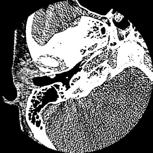 EAR CT - Skull, Head, and Neck CTs - embodi3D.com