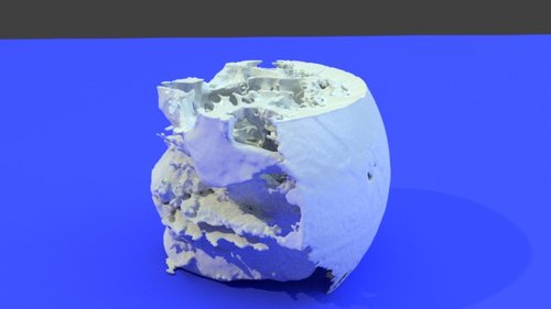 vidya goyal - stl file processed - Dental, Orthodontic, Maxillofacial ...