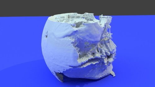 vidya goyal - stl file processed - Dental, Orthodontic, Maxillofacial ...