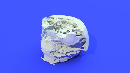 vidya goyal - stl file processed - Dental, Orthodontic, Maxillofacial ...