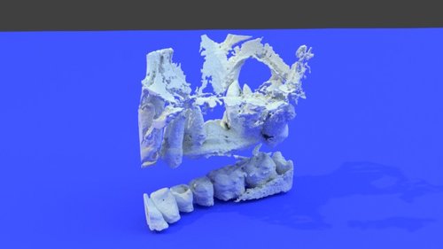 CBCT Scan - stl file processed - Dental, Orthodontic, Maxillofacial ...