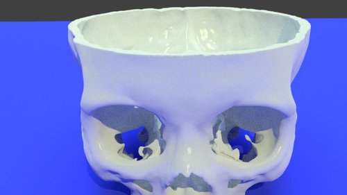 test - stl file processed - Dental, Orthodontic, Maxillofacial ...