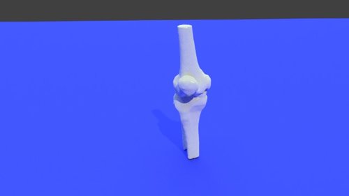 knee joint - stl file processed - Extremity, Lower (Leg) - embodi3D.com
