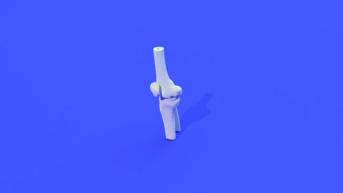 knee joint - stl file processed - Extremity, Lower (Leg) - embodi3D.com