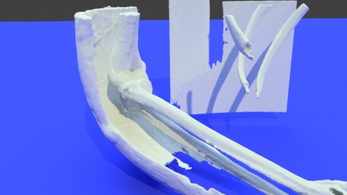 series1 - stl file processed - Extremity, Upper (Arm) - embodi3D.com