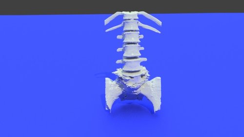 Lumbar 001 - stl file processed - Spine and Pelvis - embodi3D.com