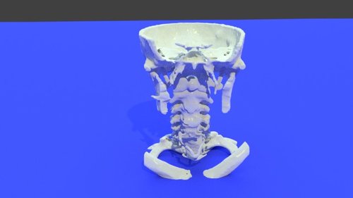 20190702 Cervical DETAILED BONES LTD - stl file processed - Spine and ...
