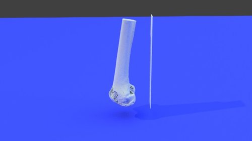 Cadaver Distal Femur - stl file processed - Extremity, Lower (Leg ...