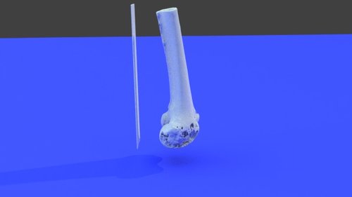 Cadaver Distal Femur - stl file processed - Extremity, Lower (Leg ...