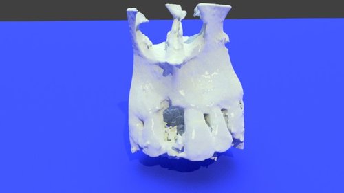 DCM 2 - stl file processed - Dental, Orthodontic, Maxillofacial ...