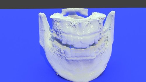 CTA Teeth Scan - stl file processed - Dental, Orthodontic ...