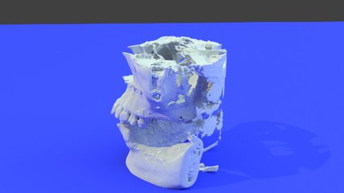 dental_cbct_scan - stl file processed - Dental, Orthodontic ...