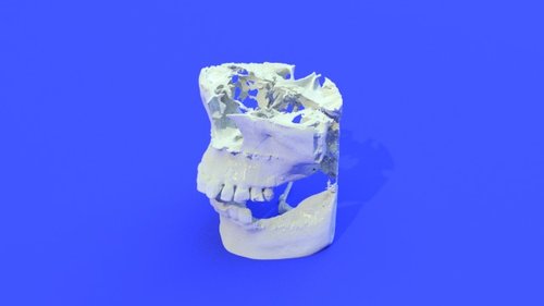 dental_cbct_scan - stl file processed - Dental, Orthodontic ...