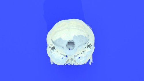 second CT scan facial and cervical - stl file processed - Spine and ...