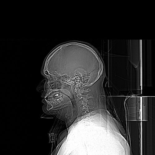Dwayne Lee CT scan - Skull, Head, and Neck CTs - embodi3D.com