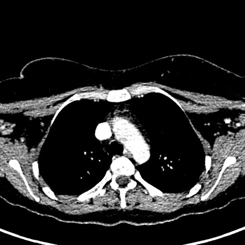 skin august - Skull, Head, and Neck CTs - embodi3D.com