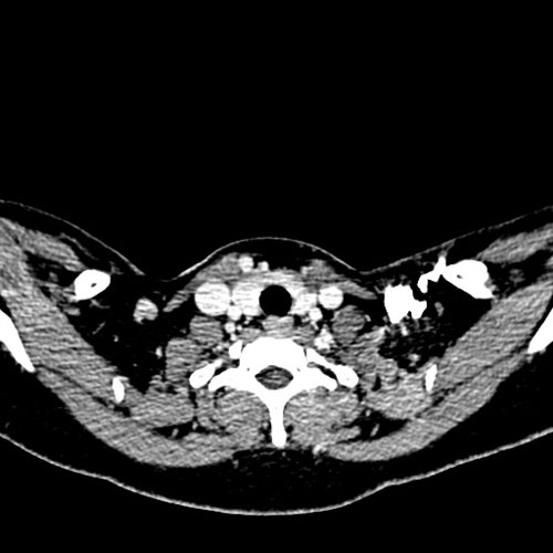 skin august - Skull, Head, and Neck CTs - embodi3D.com