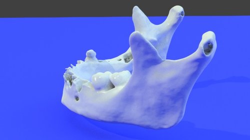 Mandibulas - stl file processed - Dental, Orthodontic, Maxillofacial ...