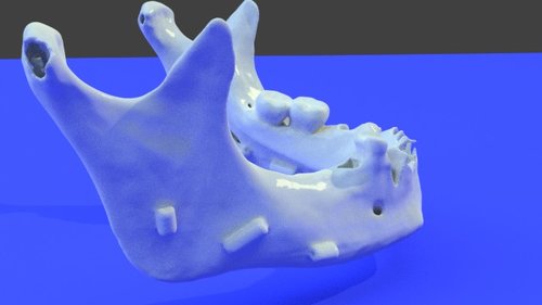 Mandibulas - stl file processed - Dental, Orthodontic, Maxillofacial ...