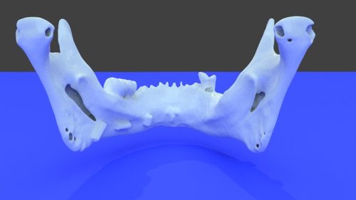 Mandibulas - stl file processed - Dental, Orthodontic, Maxillofacial ...