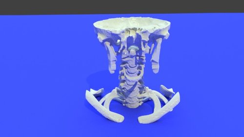 second CT scan facial and cervical - stl file processed - democratiz3D ...