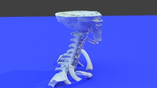 second CT scan facial and cervical - stl file processed - democratiz3D ...