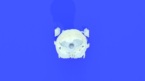 second CT scan facial and cervical - stl file processed - democratiz3D ...