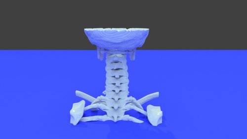 second CT scan facial and cervical - stl file processed - democratiz3D ...