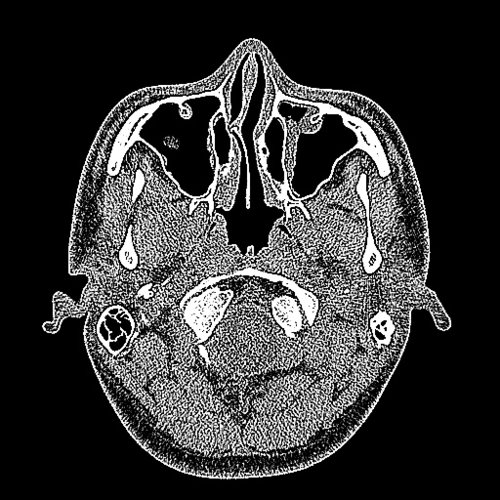 Head CT Scan - Skull, Head, and Neck CTs - embodi3D.com