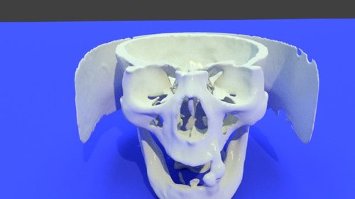 Test - stl file processed - Dental, Orthodontic, Maxillofacial ...