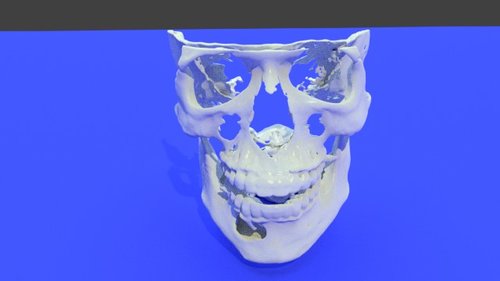 Skull CT - stl file processed - Dental, Orthodontic, Maxillofacial ...