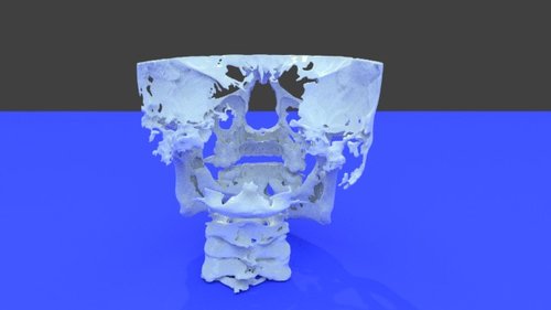 Skull CT - stl file processed - Dental, Orthodontic, Maxillofacial ...