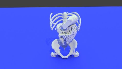 CT Scan - stl file processed - democratiz3D® Processing - embodi3D.com