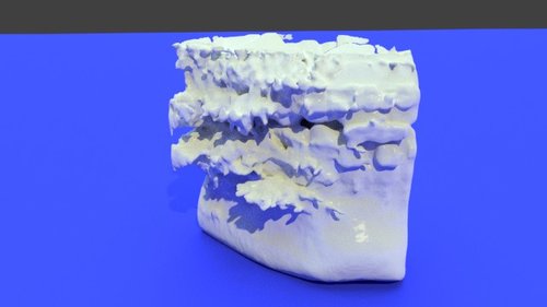 cbct MANDIBULAR - stl file processed - Dental, Orthodontic ...