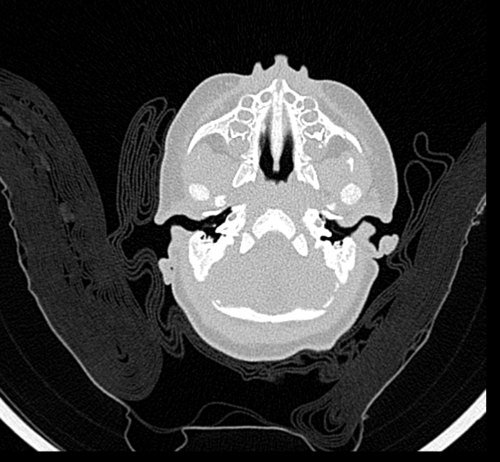 infant male axial thin bone CT scan skull/head - Skull, Head, and Neck ...