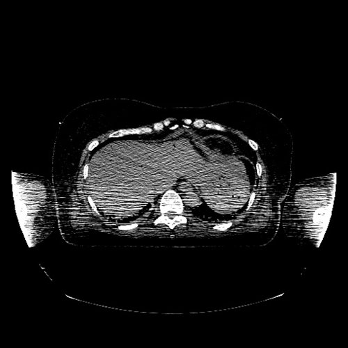 female_pelvis - Whole Body CTs - embodi3D.com