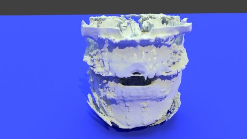 Lower Facial Scan - stl file processed - Dental, Orthodontic ...