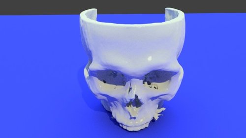 Sinus scan - stl file processed - Dental, Orthodontic, Maxillofacial ...