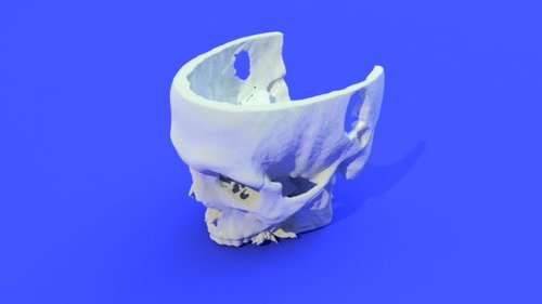 Sinus scan - stl file processed - Dental, Orthodontic, Maxillofacial ...