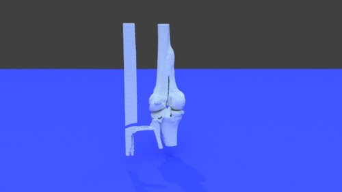 bone knee joint - stl file processed - Extremity, Lower (Leg ...