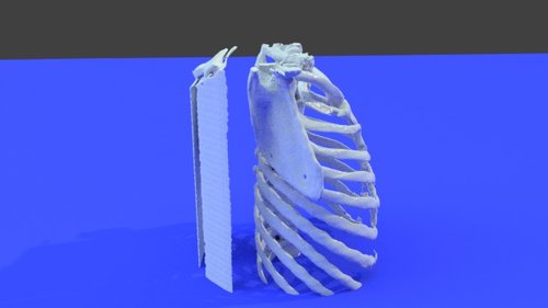 this all file converted to stl - stl file processed - Thorax and Ribs ...