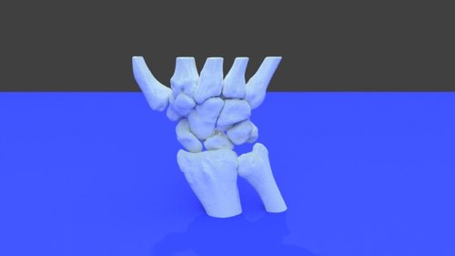 Right Scaphoid Fracture - stl file processed - Extremity, Upper (Arm ...