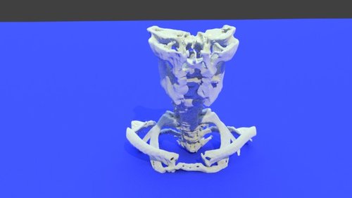 scan Neck - stl file processed - Spine and Pelvis - embodi3D.com
