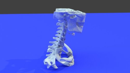 scan Neck - stl file processed - Spine and Pelvis - embodi3D.com