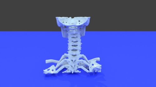 scan Neck - stl file processed - Spine and Pelvis - embodi3D.com