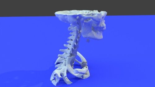 scan Neck - stl file processed - Spine and Pelvis - embodi3D.com